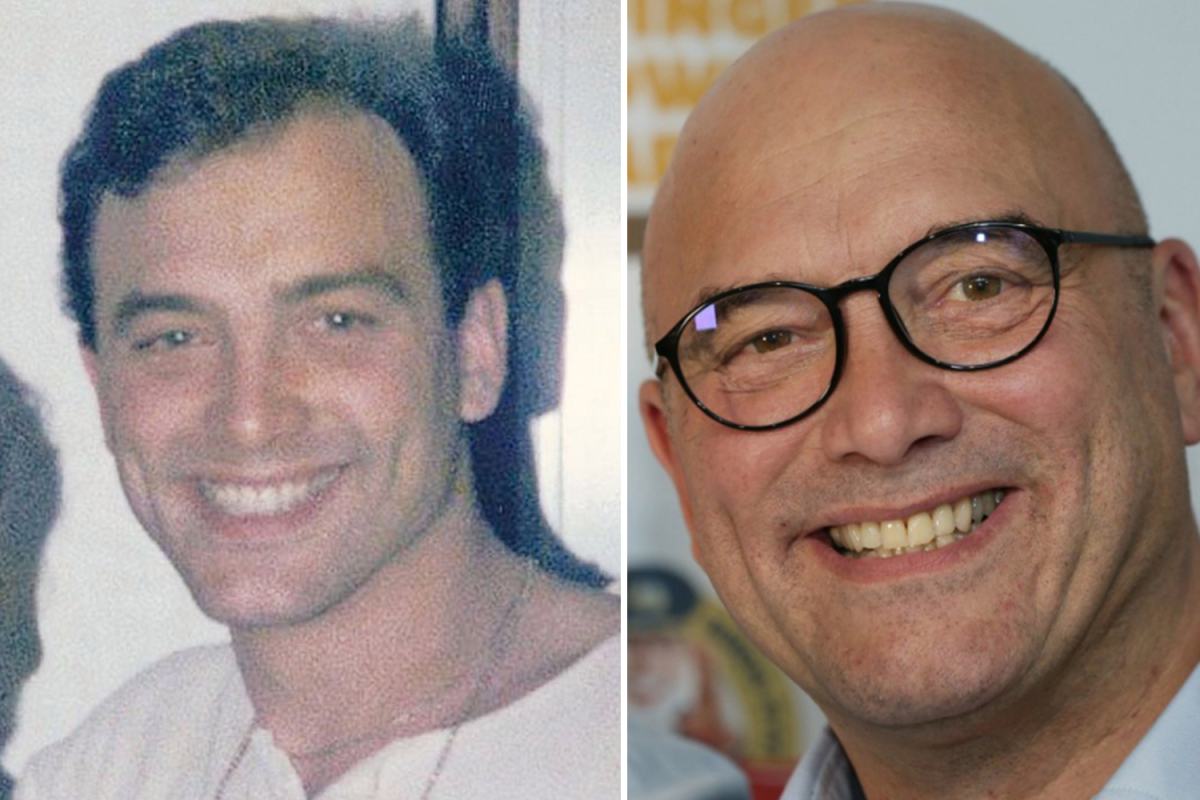 13 Celebrities You’ve Never Seen With Hair – nicehair.org