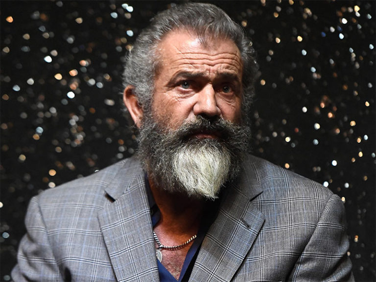 7 celebrities who have had hair transplants – nicehair.org