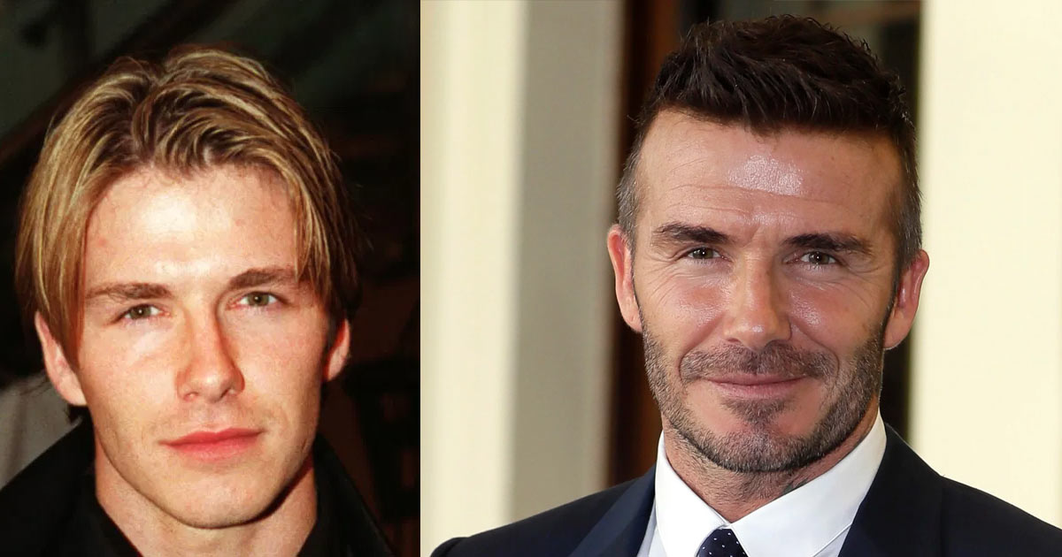 David Beckham Hair Loss: Investigating the Facts – nicehair.org